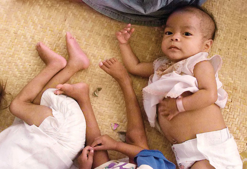 La tragedia y la agonía de la desnutrición infantil en Guatemala ...